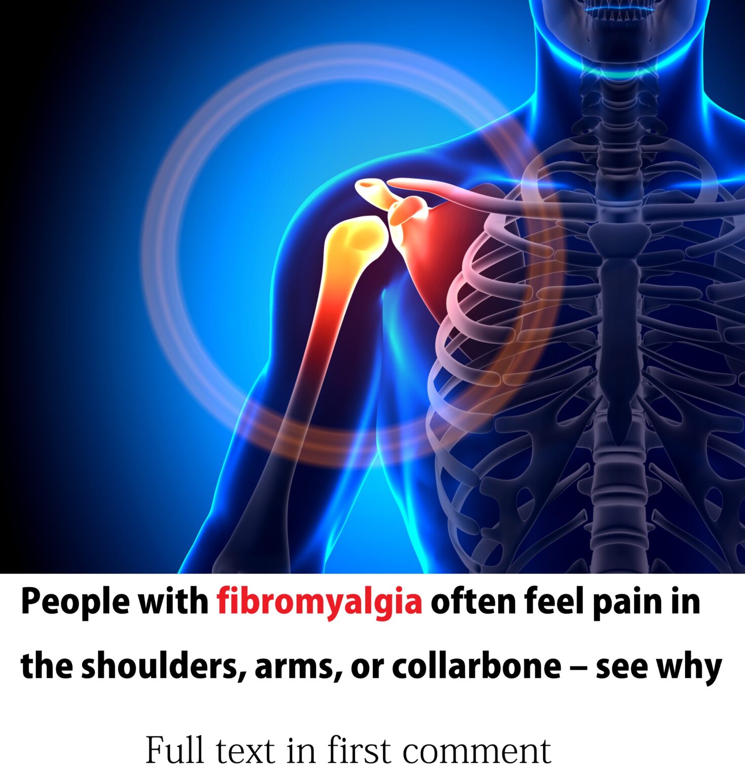People with fibromyalgia often feel pain in the shoulders, arms, or ...