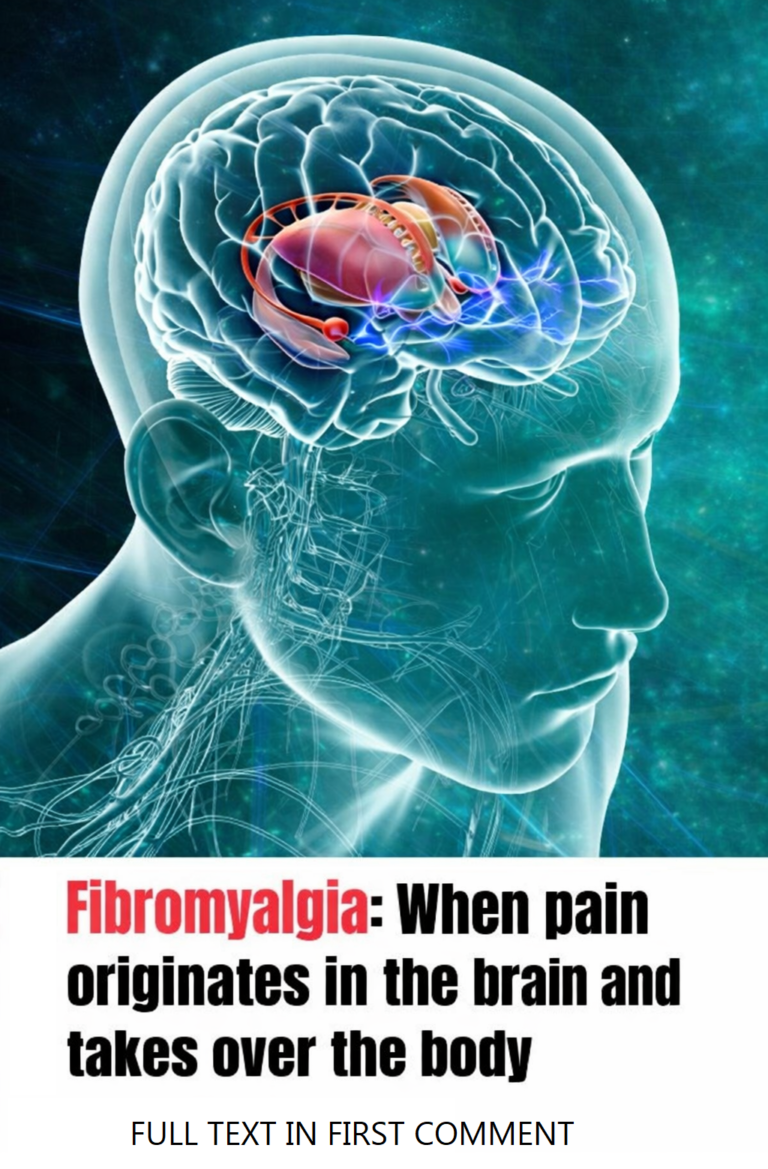 Fibromyalgia and the Brain: Understanding Chronic Pain Beyond Muscles ...