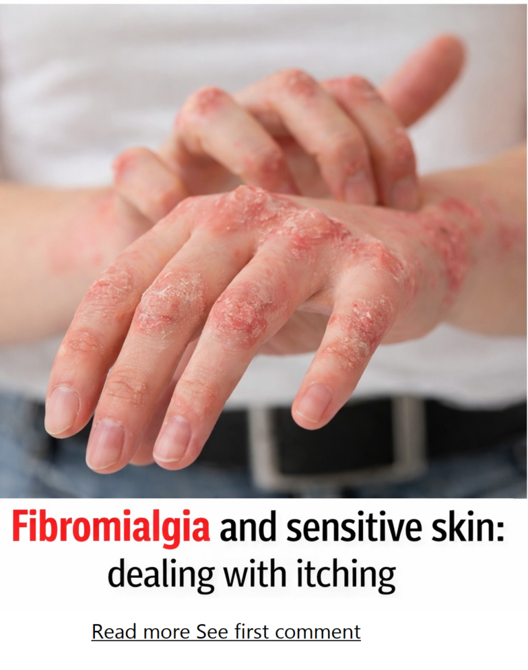 When the Skin Hurts: Understanding Itching and Sensory Sensitivity in ...
