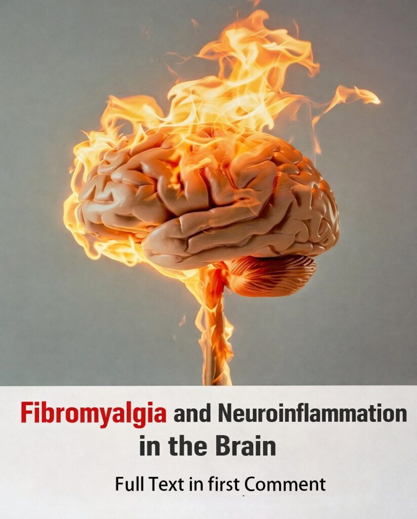 Neuroinflammation in Fibromyalgia: How Brain Inflammation Triggers ...